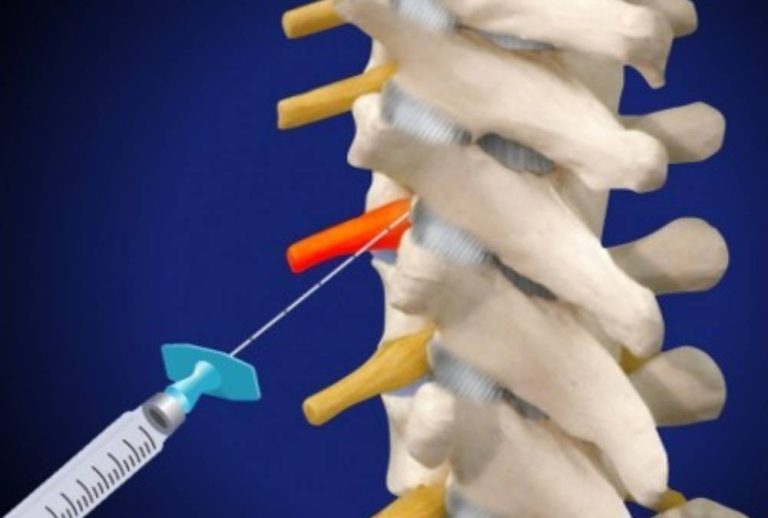Treatments Offered | Ashirvad Institute for Pain Management and ...