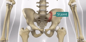 Hip Pain Management | Pain Care India